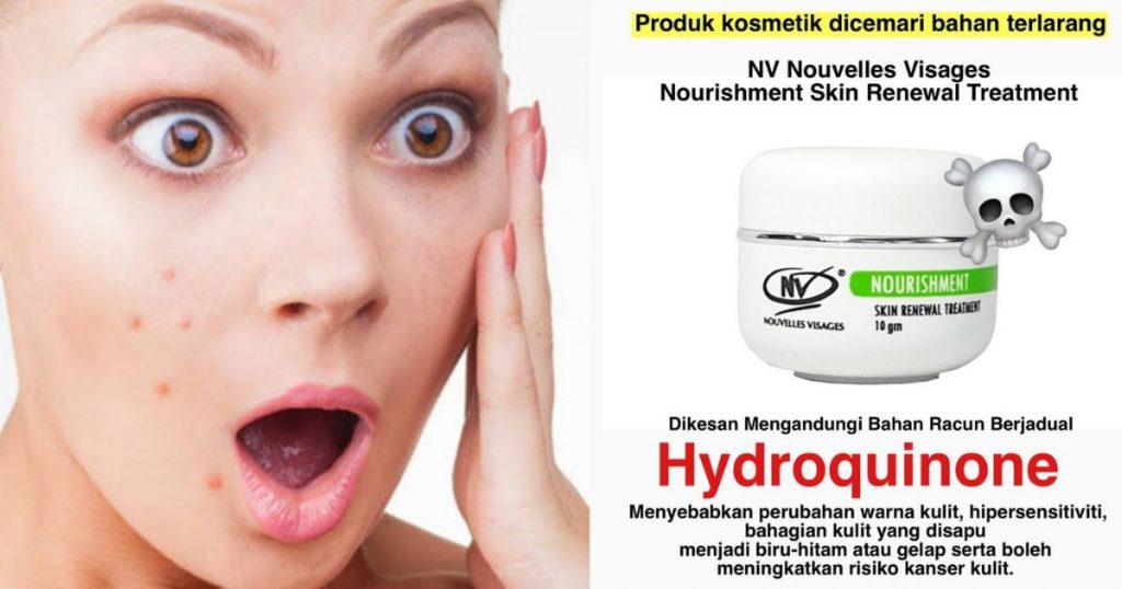 KKM Brunei Kesan Produk Kosmetik Dari Malaysia, Mengandungi Racun ...