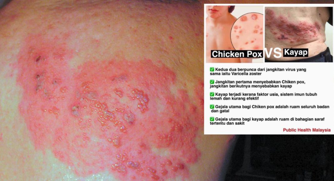 Katanya Kayap Ular Boleh Bersambung, Tapi Rupanya Hanya Mitos. Doktor ...